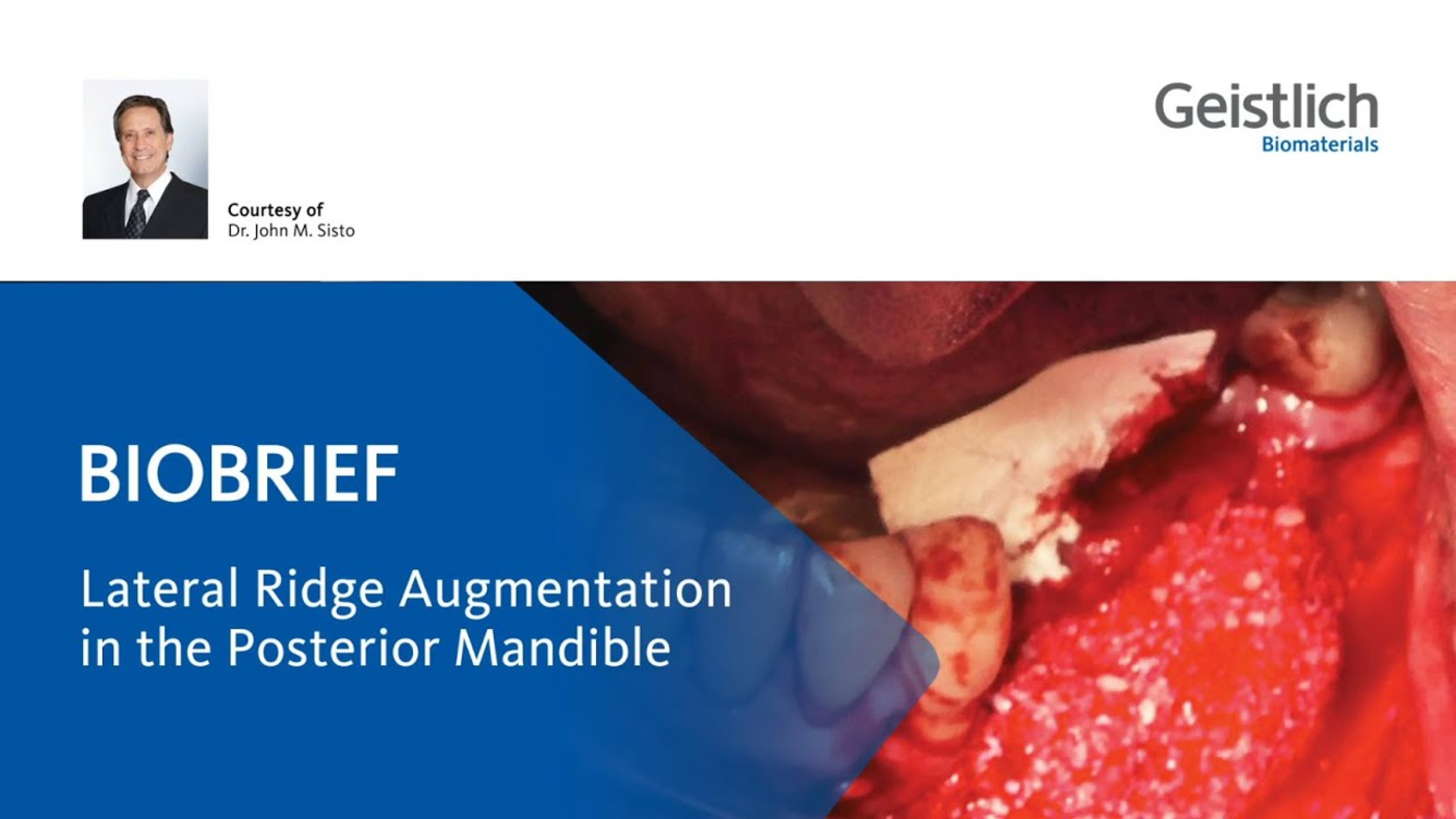 Regeneration Expert: Ridge augmentation in the posterior mandible