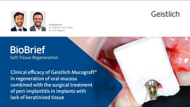 Regeneration Expert: Efficacy of Geistlich Mucograft ® for lack of ...